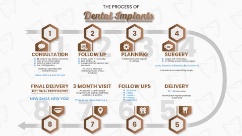 Dental Implants - Matrix Dental Specialists